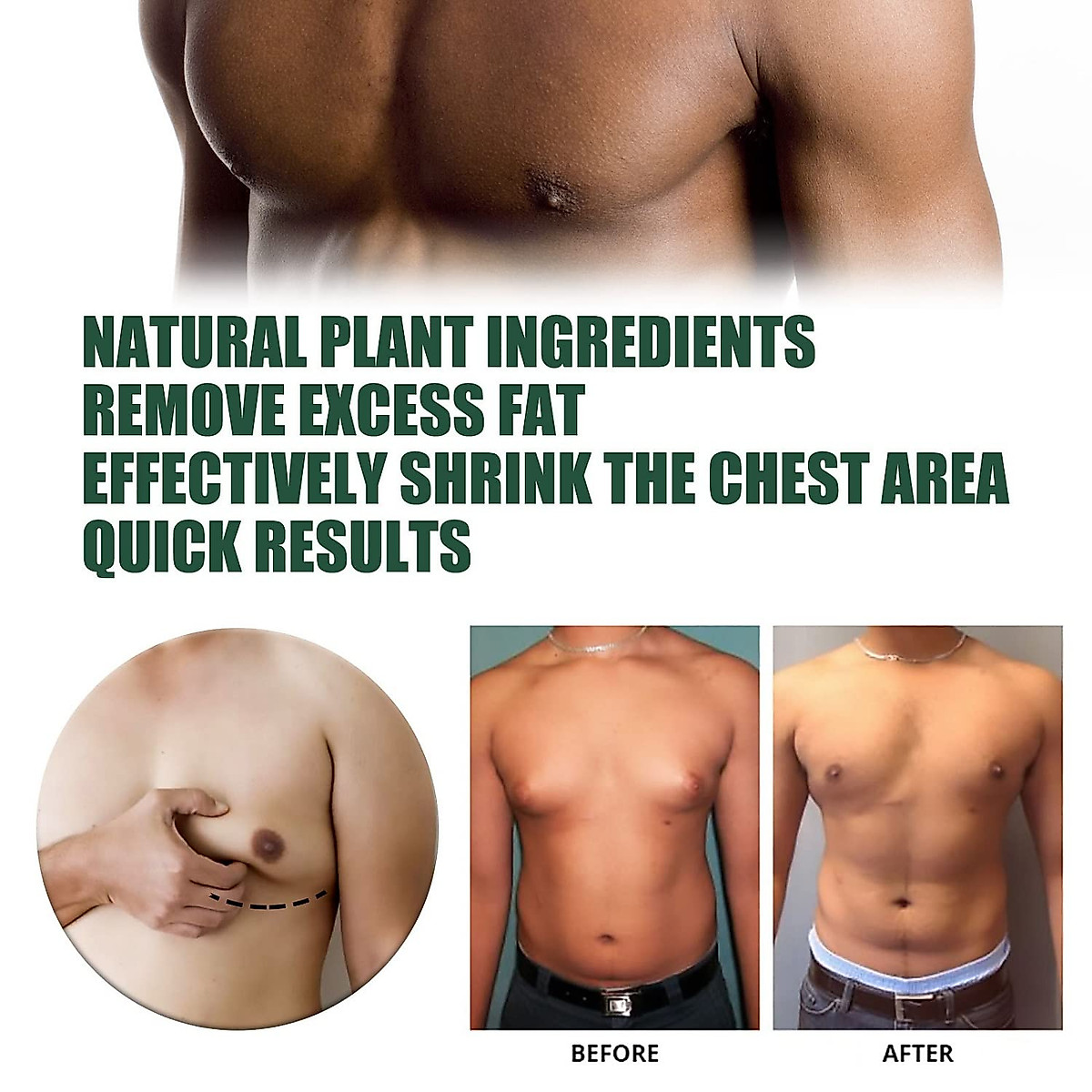 YG LianKai 2pcs Gynecomastia Tightening Ginger Cream, Ginger Cream for Men, Effectively Shrinks Men Chest Tightening Ginger Cream