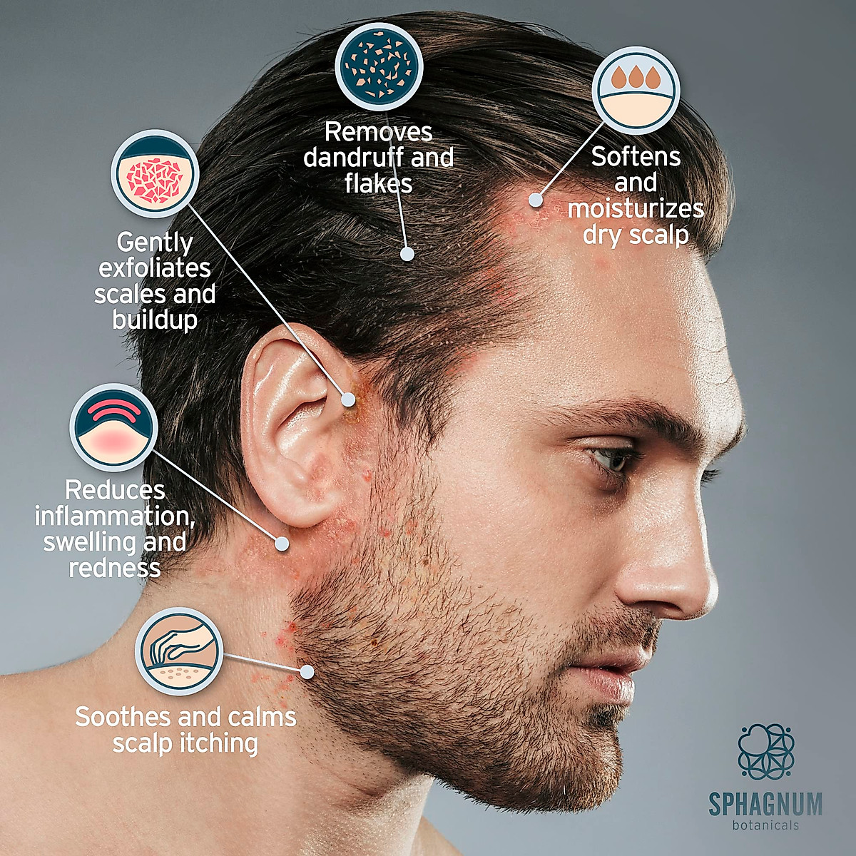 Psoriasis Serum and Shampoo