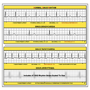 R-CAT for Arrhythmias EKG Pocket Reference Guide – Great Study Card for EKG Interpretation - ACLS and PALS Training – Cardiac Rhythm Interpretation Made Easy