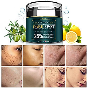 CITYGOO Dark Spot Remover for Face and Body, Dark Spot Corrector Cream, Natural Ingredient,Enriching Skin Care For All Skin Tones - Melasma, Freckle, Sun Spot Remover & Blemish Reducer-1.7 FL OZ