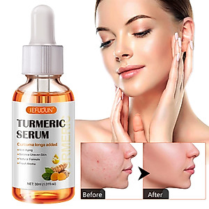 2 Pack Turmeric Serum for Dark Spots, Turmeric Dark Spot Corrector Serum for Acne, Hyperpigmentation and Smooth Skin, Formulated with Hyaluronic Acid, Vitamin C & E - 1.01 FL.OZ