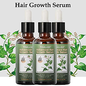 Hair Growth Serum, Hair Loss Treatments, Hair Serum, Hair Growth Oil for Thicker Longer Fuller Healthier Hair, Help Hair Follicle Growth, Prevent Hair Loss and Thinning, With Natural Vitamin Rich Trea