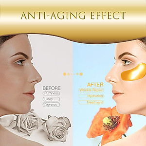 HOPEMATE Eye Patches, Under Eye Mask, 24K Gold Eye Treatment Mask, Dark Circles Gel Pads, Under Eye Bags Treatment for Puffy Eyes, Anti-Wrinkle , 14 Pairs