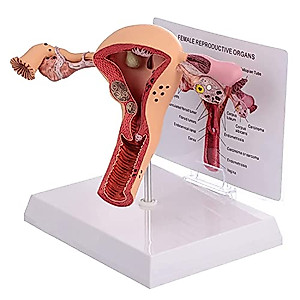 ROLTIN Human Pathological Uterus Model Internal Reproductive System Organ Anatomical Model Human Anatomy Model for Medical Training Aid