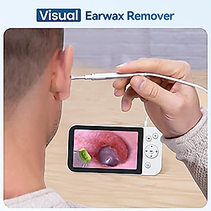 Anykit Digital Otoscope with 5 Inch IPS Screen, Visual Ear Cleaner with 3.9mm Ear Wax Removal Camera, 6 LED Lights, 32GB Card, Storage Case, 100Pcs Disposable Specula, 12 Ear Spoons