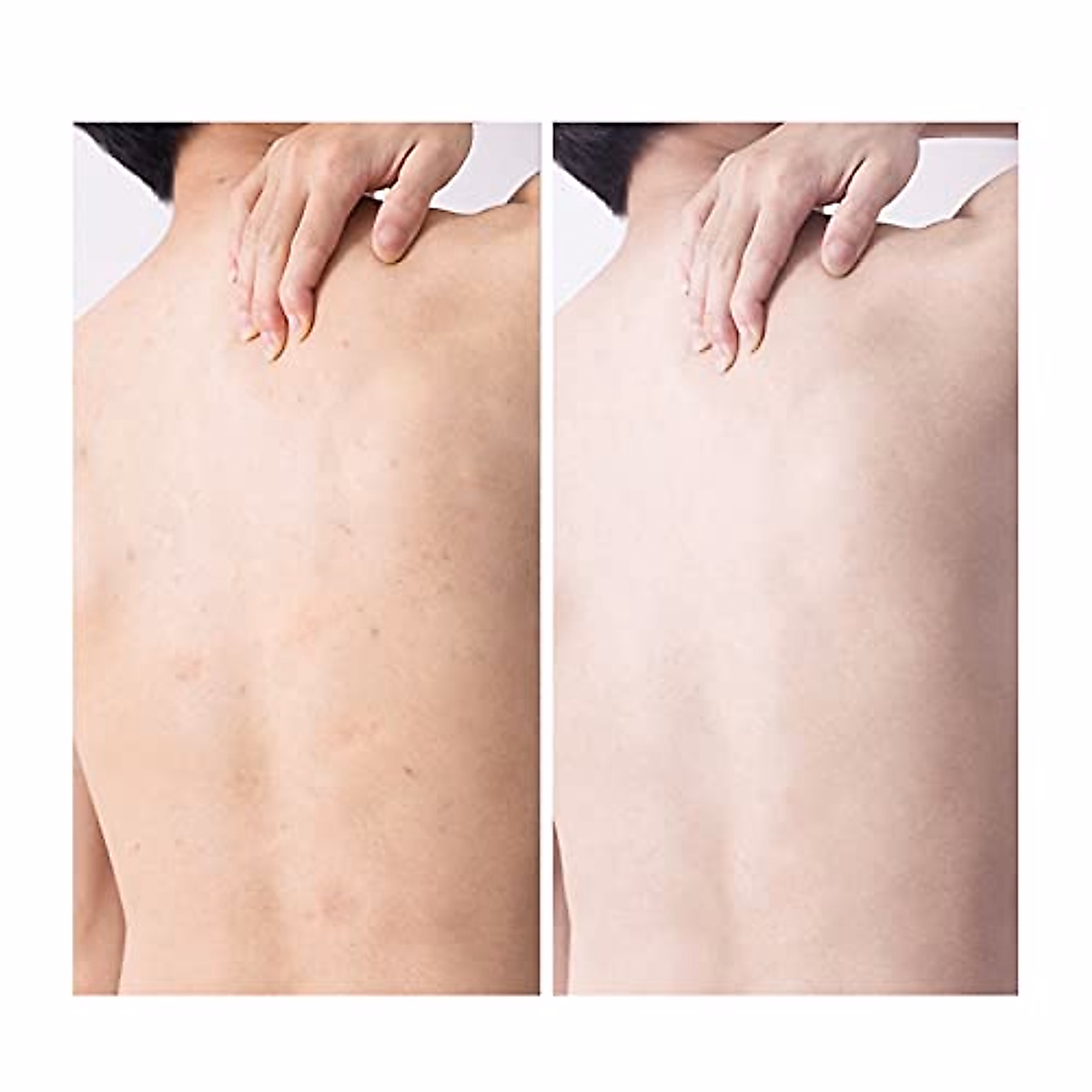 Exfoliating Back Scrubber for Shower,Back Washer For Shower with Korean Exfoliating Gloves Mitt for Body Cleansing,Exfoliating Body Scrubber for Men and Women