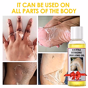 Peeling Oil for Dark Skin, Yellow Peeling Oil, Strong Peeling Oil Extra Strength, Exfoliating Peeling Solution for Body All Skin Type -110ML/3.66 OZ