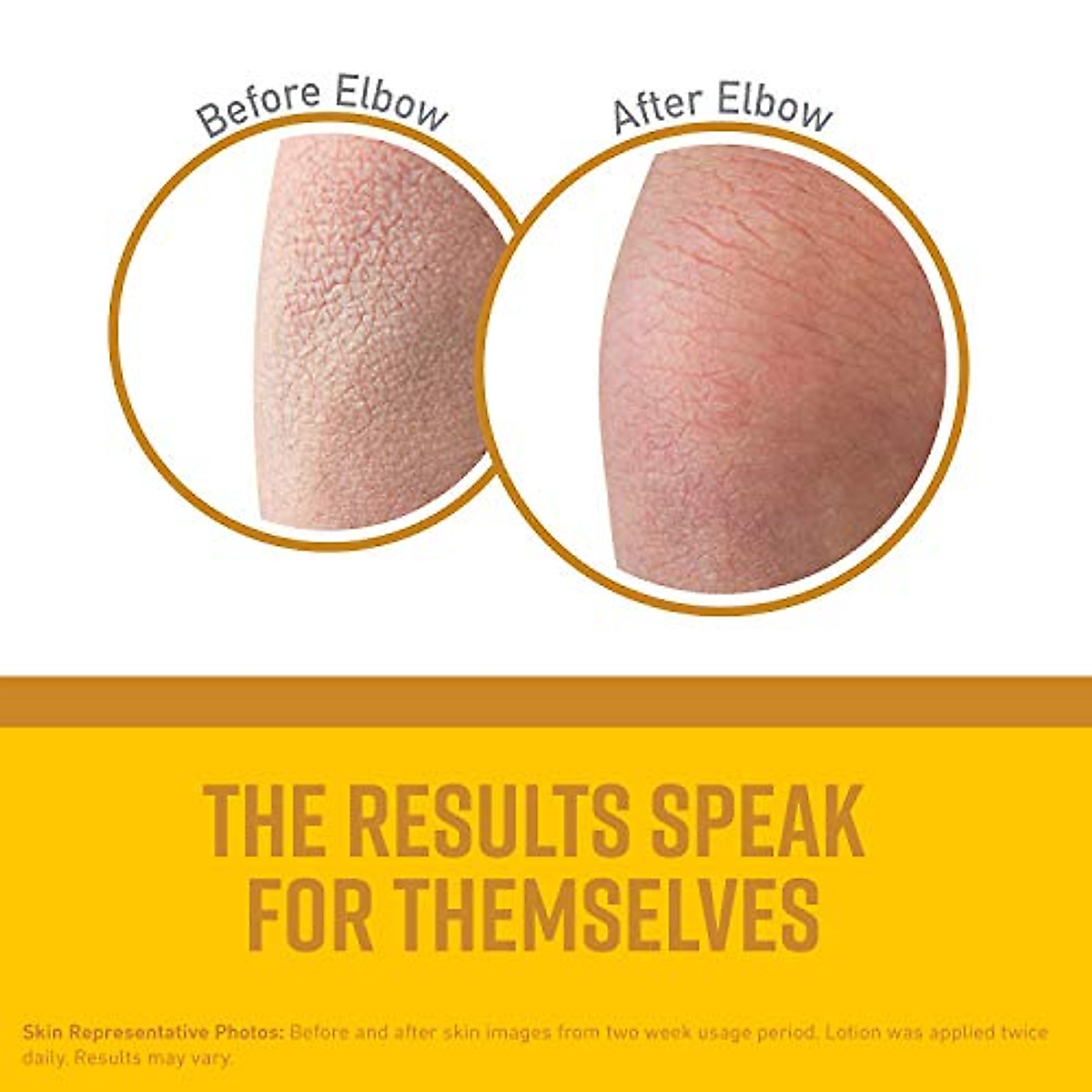 O'Keeffe's Skin Repair Body Lotion and Dry Skin Moisturizer, 7 Ounce Tube, (Pack of 4)