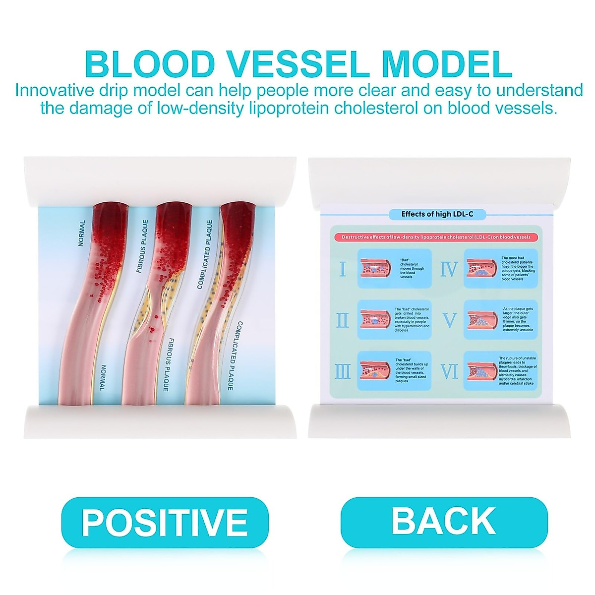 Human Body Skeleton Anatomical Model Low- Density Lipoprotein Blood Vessel Model