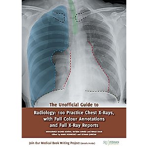 The Unofficial Guide to Radiology: 100 Practice Chest X Rays with Full Colour Annotations and Full X Ray Reports (Unofficial Guides)