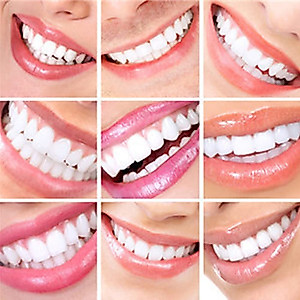 Dentistry Hygiene Oral Care Fresh Breath Teeth Tooth Tongue Cleaning Cleaner Toothbrush Scraper Flosser Whitening Kits