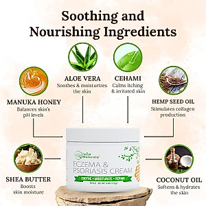 Wild Naturals Eczema & Psoriasis Cream for Dry, Itchy Skin – Eczema Relief Cream for Adults & Kids – Moisturizing Psoriasis Cream with Manuka Honey