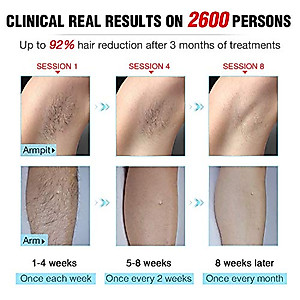 Laser Hair Removal Permanent, IMENE Painless IPL Hair Removal - Ideal for Women & Men Bikini, Legs, Arms, Armpits Hair Remover - Uses Most Effective IPL Technology (Intense Pulsed Light) Blue