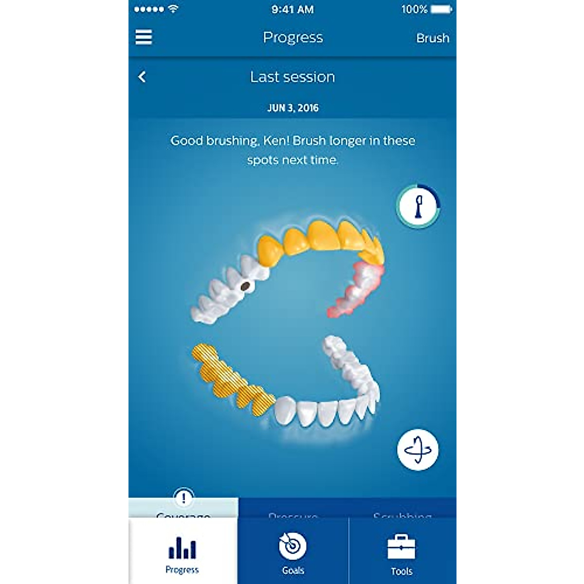 Philips Sonicare DiamondClean Smart 9500 Rechargeable Electric Power Toothbrush, Black, HX9924/11