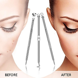 [Dual Ended] 7PCS Blackhead Remover, Comedone Pimple Extractor, Acne Whitehead Blemish Removal Kit, Professional Stainless Steel Clean Tool, for Face Nose Chin Cheek Forehead