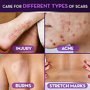 Cicatricure Scars Gel 1oz Tube Multipack Value Deal Pack of 3 Tubes