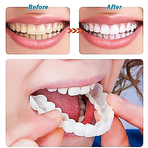 Fake Teeth,2 Pairs Veneers Dentures Socket for Women and Men,Dental Veneers for Temporary Tooth Repair Upper and Lower Jaw,Protect Your Teeth and Regain Confident Smile,Bright White