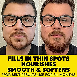 Beard Club - Beard Growth Oil - Grow A Thicker Fuller Beard, Fill in Patches - Healthy Natural Castor, Coconut and Avocado Beard Growth Serum to Stimulate Thicker, Fuller, Healthier Facial Hair Growth