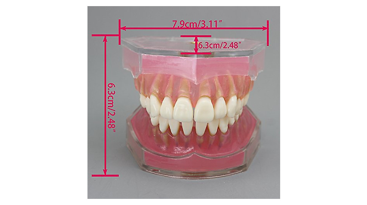 Dental Implant Model for Training and Teaching