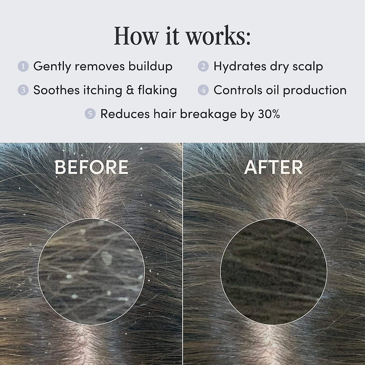 Jupiter Dandruff Shampoo, Conditioner, and Serum Trio, Relieves Itchy, Dry, & Flaky Scalp, Color-Safe, & Sulfate-Free, Made with Zinc, Coconut Oil, and Green Tea