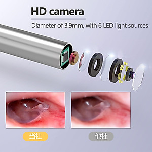 Ear Wax Removal AMTORIN 1080P,No WiFi Needed, Plug and Play,Earwax Remover Tool Compatible with iPhone 15,iPhone and Android Phone, Photo and Video Function, Ear Cleaner for iOS and Android (3.9mm)