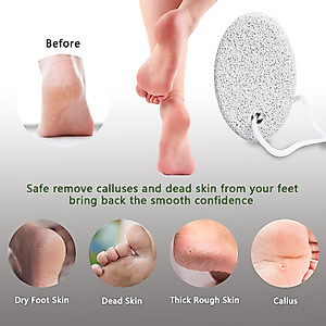4-Pack Natural Pumice Stone for Feet, Borogo Lava Pedicure Tools Hard Skin Callus Remover for Feet and Hands - Natural Foot File Exfoliation to Remove Dead Skin, Heels, Elbows, Hands