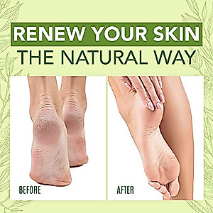 Tea Tree Oil Foot Cream - Instantly Hydrates and Moisturizes Cracked or Callused Feet - Rapid Relief Heel Cream - Natural Treatment Helps & Soothes Irritated Skin, Athletes Foot, Body Acne