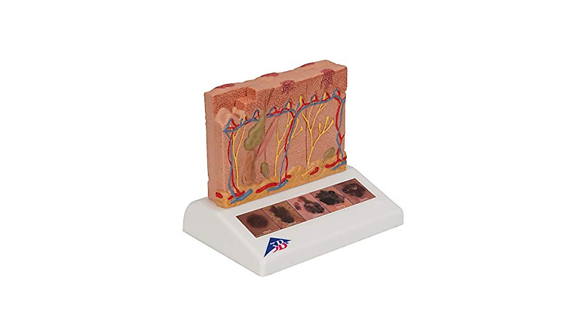 3B Scientific J15 Skin Cancer Model - Study Skin Pathology