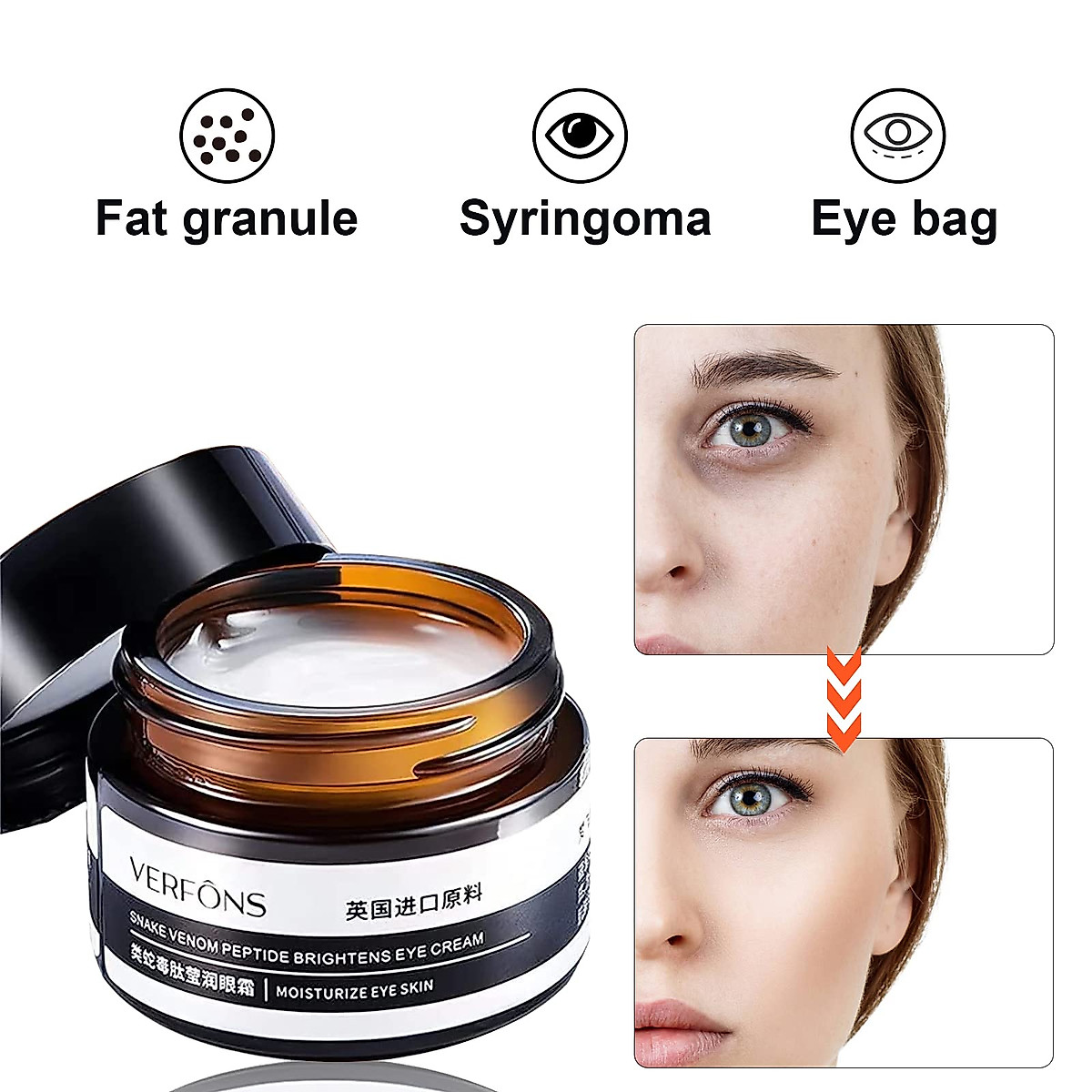 2PCS Verfons Firming Eye Cream,Verfons Snake Venom Firming Eye Cream, Verfons Temporary Firming Eye Cream for Bags, Anti Aging Eye Bag Cream, Instant Remove Eye Bags Fades Fine Lines and Wrinkles