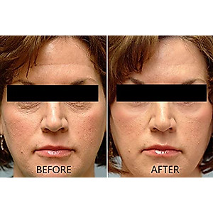 Vitamin C Serum 20% Pure L-Ascorbic Acid, Ferulic Acid, Vitamin E and HA and Hyaluronic Acid Serum with Vitamin B5 for Face and Eyes Natural Anti Aging Anti Wrinkle Set of 2 by Dr. Brenner