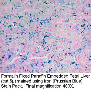 Iron (Prussian Blue) Stain Pack, 500ml