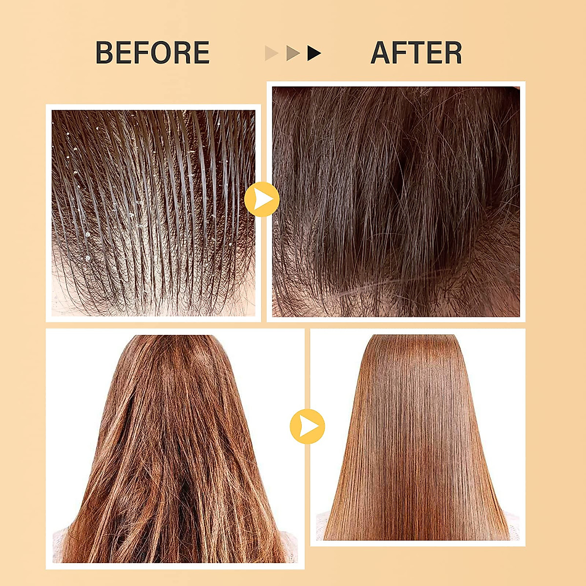 Scalp Scrub with Sea Salt and Ginger, Gentle Scalp Exfoliating, Removes Buildup, Dandruff Dry Scalp Treatment and Nourishing Hair, Parabens-free (10.6 oz / 300 g)