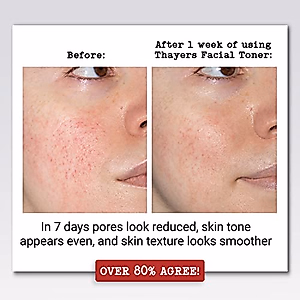 THAYERS Alcohol-Free Rose Petal Witch Hazel Facial Toner with Aloe Vera Formula, 12 Ounce