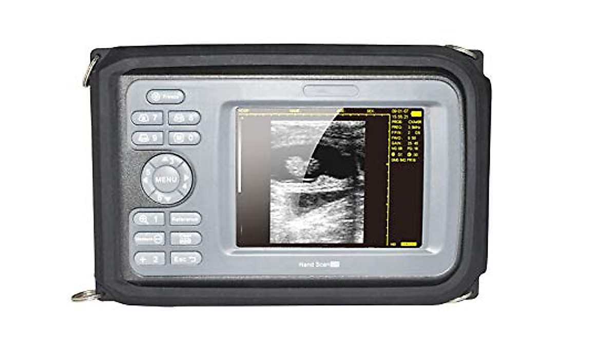 Portable Veterinary Ultrasound Scanner for Large Animals