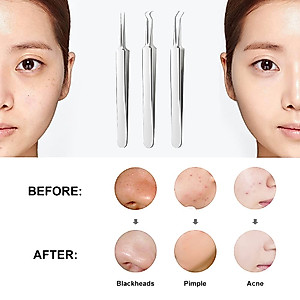 La Chat Blackhead Remover Kit - Blackhead Tweezers Removal Tool 3 pcs Comedone Pimple Extractor Tool, Acne Blemish Kit for Blackhead, pimple Tool, Curved Blackhead Tweezers kit (3 pcs)