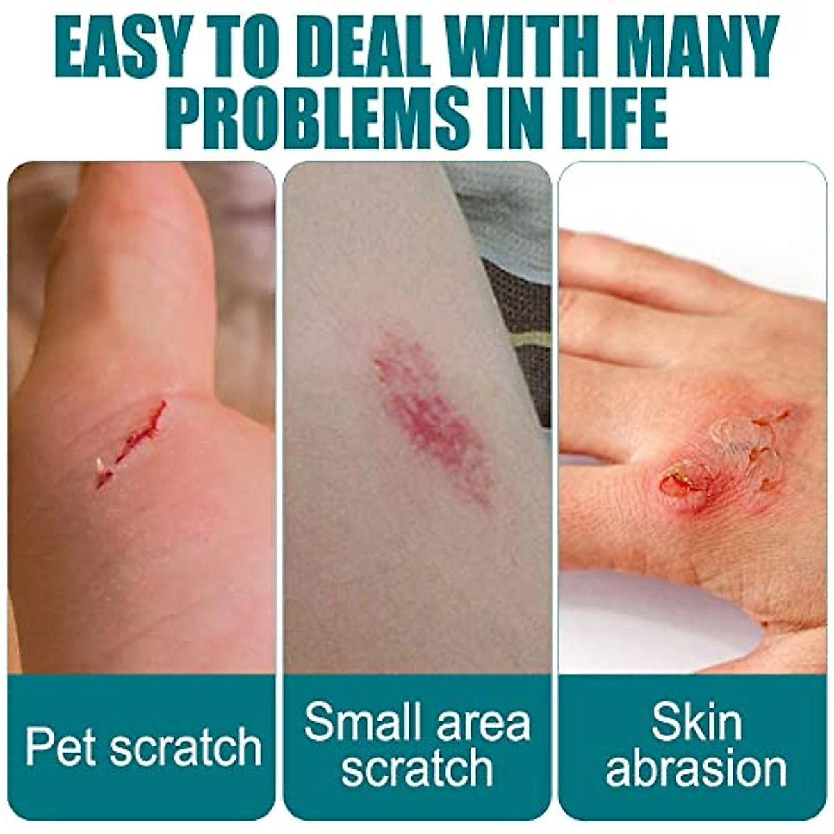 Skin Souffle Liquid Watertightness 10ml Watertightness Plaster Liquid Dressing Transparent Dressing Life Tones