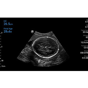 Philips Lumify C5-2 Curved Array Transducer, Portable Ultrasound Solution