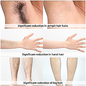 Roll on Waxing Kit for Hair Removal, Roll Waxing Kit for Women Men, Wax Heater with 2 Wax Roller Cartridge Refill for Legs Arms and Underarm(Wax Heater 1, Wax Paper 100, Pre&After Wax Oil)