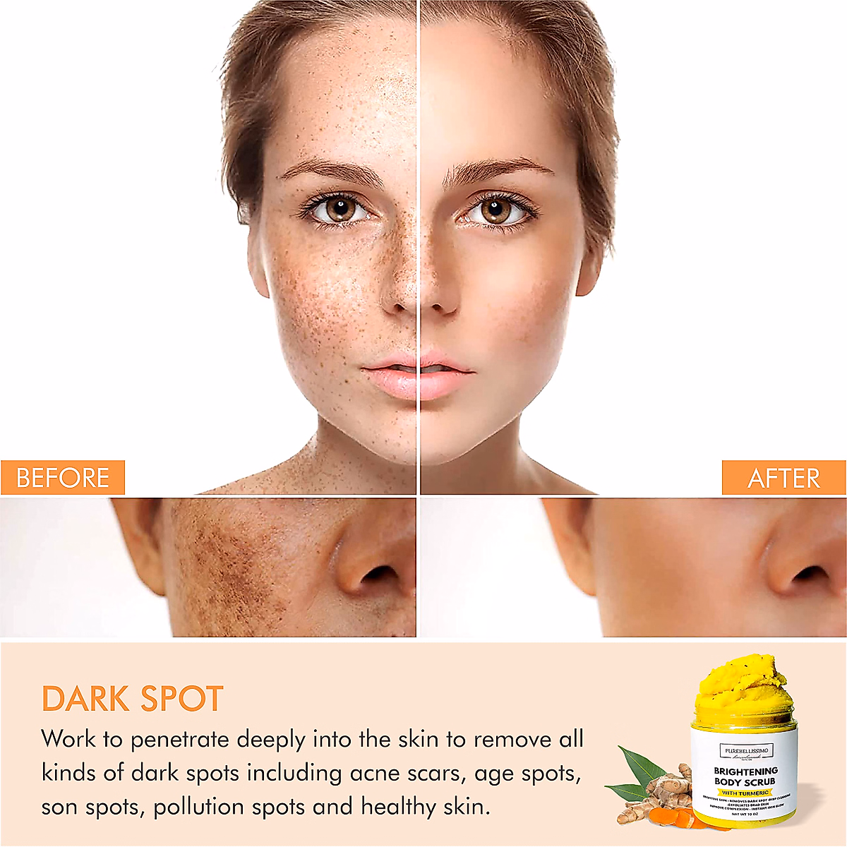 Turmeric Skin Brightening Scrub for Dark Spots, Dark Inner Thighs Bikini Area Underarms, Natural Exfoliating Turmeric Face Scrub ALL NATURAL 10OZ