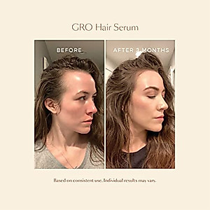 VEGAMOUR GRO Hair Serum for Thicker, Visibly Longer Hair - Vegan Hair Growth Serum Designed for Thinning Hair & Hair Loss