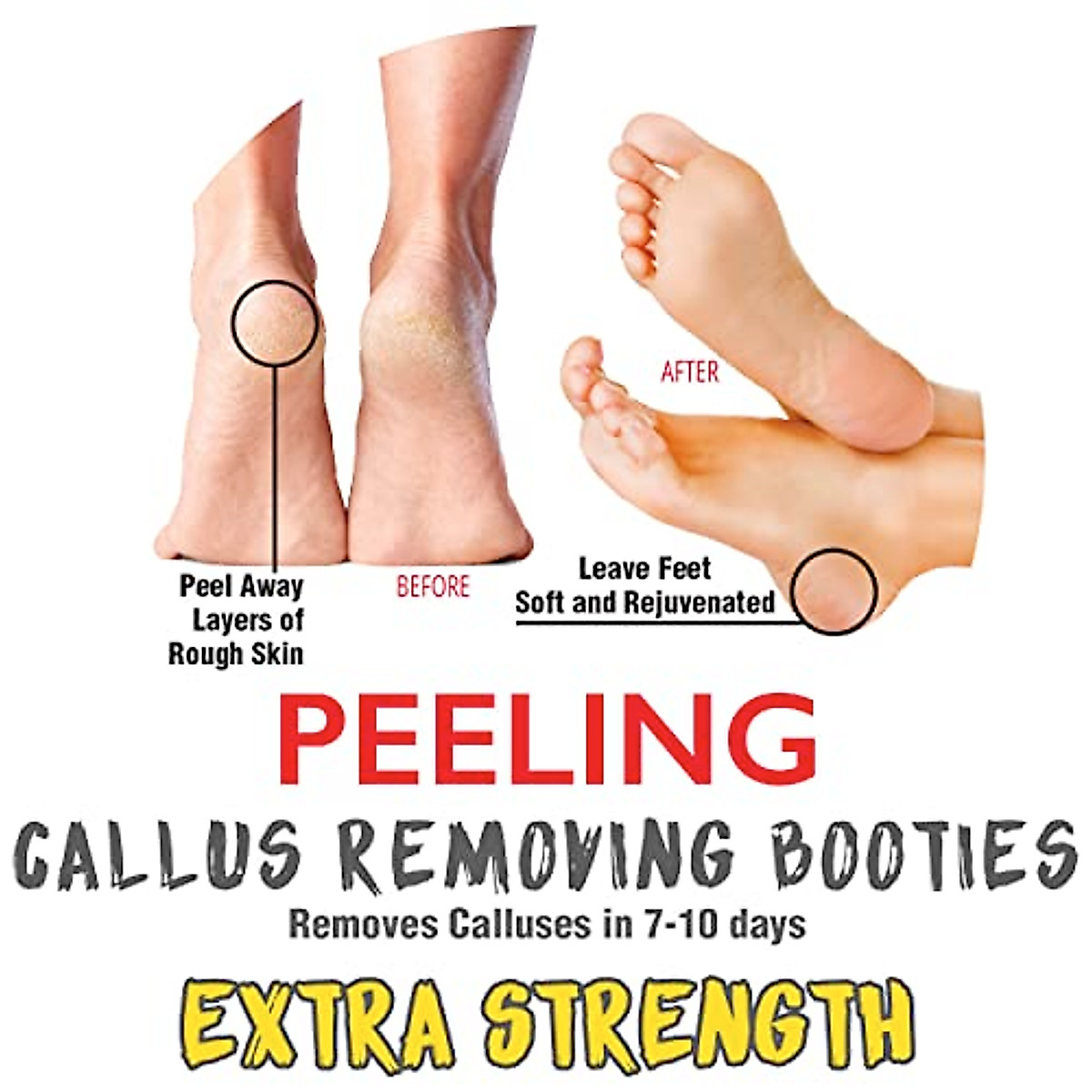 Onyx Professional Foot Peel Mask Callus Remover (2 Pack) Dead Skin Remover, Foot Exfoliator, Cracked Heel Repair - Feet Peeling Mask Pedicure Kit For Smooth Baby Soft Healthy Feet