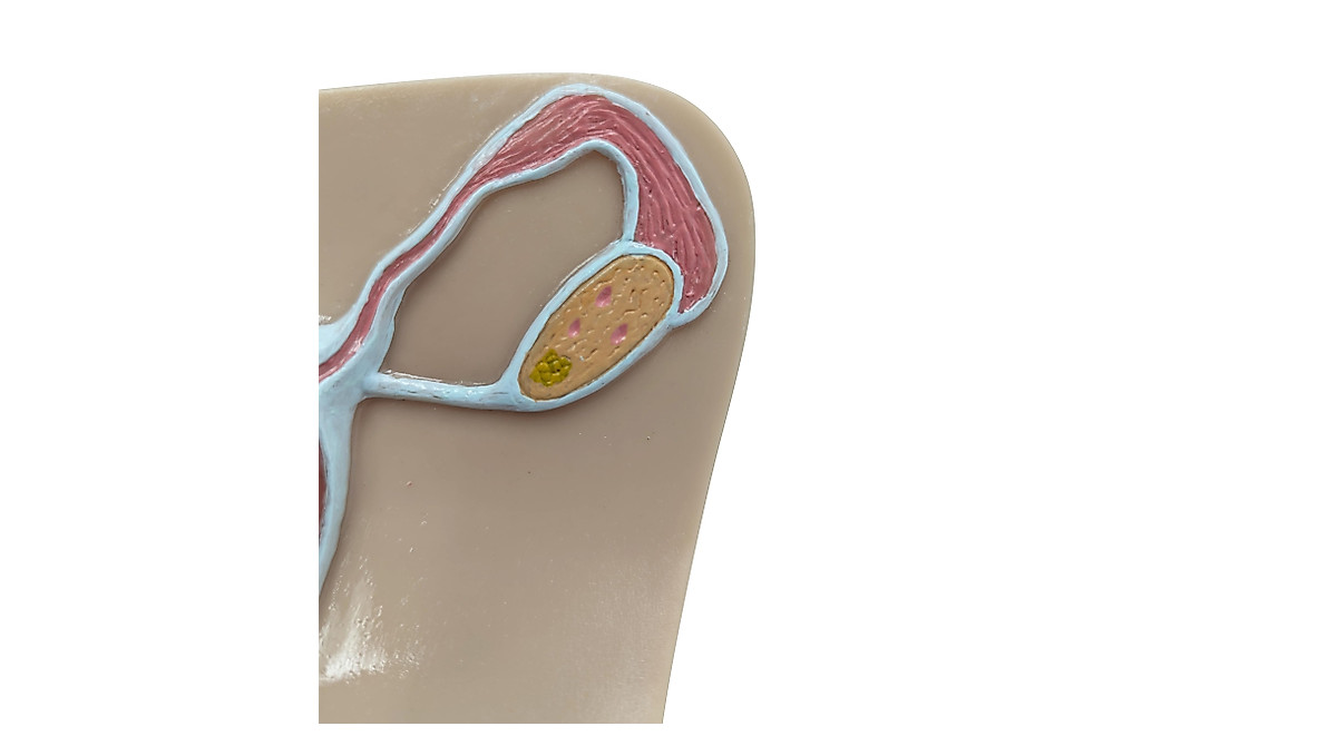 IUD Insertion Model for Medical Training