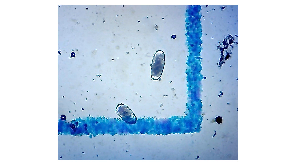 McMaster Method Microscope Slide for FEC Testing