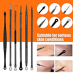 19 Pcs Blackhead Remover Pimple Popper Tool Kit,Professional Blackhead Extractor Tool for Nose Face, Stainless Comedone Extractor, Blemish Whitehead Popping Tool with Portable Metal Case (Black)