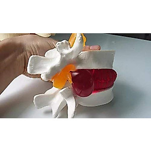 Doc.Royal Anatomical Human Lumbar Vertebrae Degenerative Lumbar Human Spine Model 1PCS