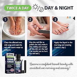 Tobcharm Toenail Fungus Treatment Extra Strength, Nail Fungus Treatment for Toenail, Fungus Nail Treatment, Nail Fungus Treatment for Fingernails (1oz)