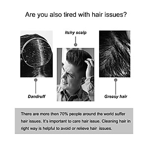 Winyoung Scalp Massager, Electric Scalp Massage Brush, Hair Massage Brush, Electric Head Scratcher, Massage Comb with Soft Rubber