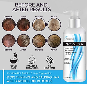 Hairgenics Pronexa Clinical Strength Hair Growth & Regrowth Therapy Hair Loss Shampoo With Biotin, Collagen, and DHT Blockers for Thinning Hair, 8 fl. oz.