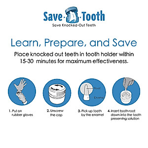 Save-A-Tooth Preservation Kit - Prevent Permanent Tooth Loss, Save Knocked Out Teeth for up to 24 Hours - Tooth Saver Made in the USA by SmartPractice - Keep in your Kit Bag for a Tooth Emergency