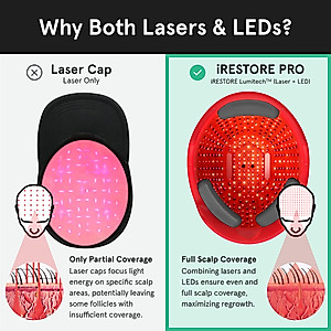 iRestore Professional Laser Red Light Therapy for Hair Growth System - FDA Cleared Hair Loss, Hair Thinning & Alopecia Treatment for Men & Women - Laser Cap for Hair Regrowth - 282 Lasers & LEDs